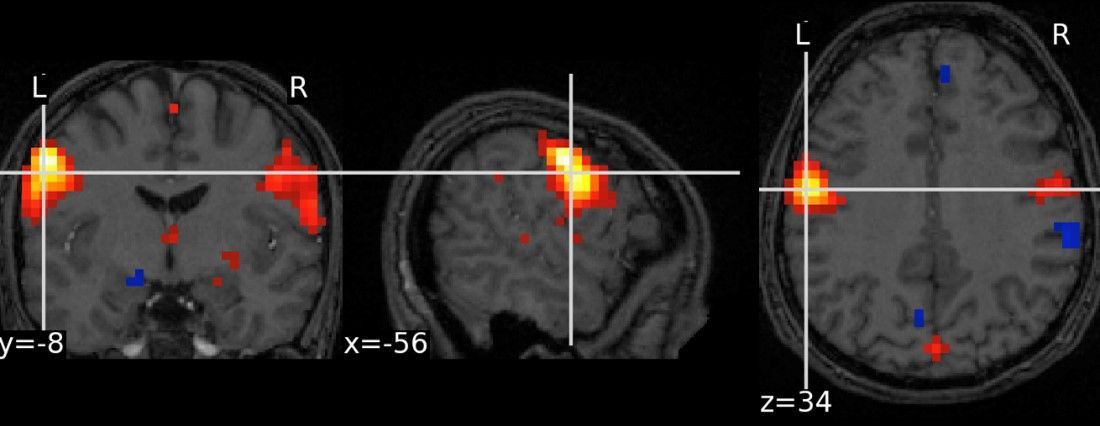 Leverage Secure Multi Party Computation (SMPC) for machine learning inference in rs-fMRI ...